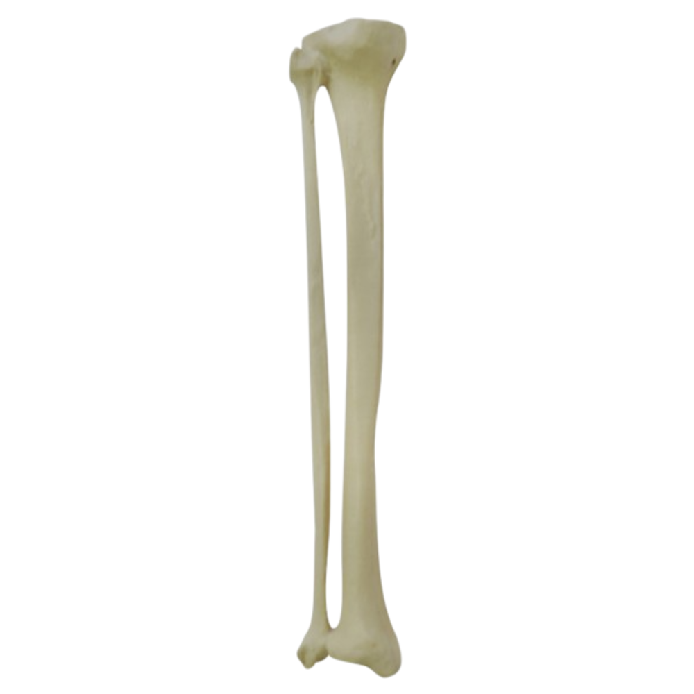 TÍBIA ESQUERDA COM CANAL MEDULAR E ESPONJOSO + FÍBULA